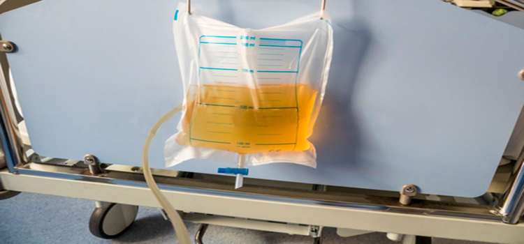 Diuresis - eSalud