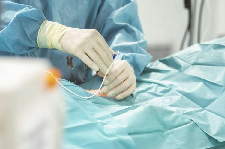 En qué consiste la rizolisis y para qué está indicada - eSalud
